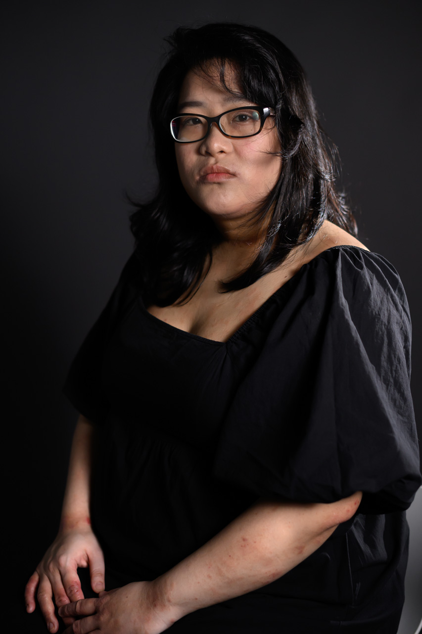 In Their Own Skin: Portraits of Eczema in Singapore