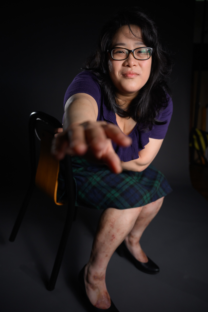 In Their Own Skin: Portraits of Eczema in Singapore